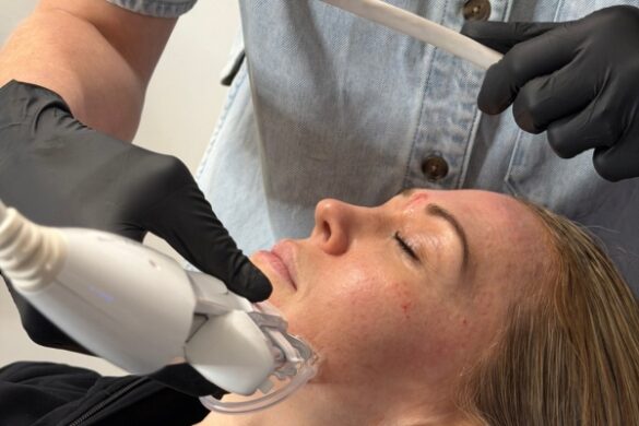 Why Your Skin Feels Different In Winter (And What Actually Helps ...